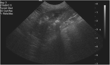 Evaluation of dogs with genetic hyperuricosuria and urate urolithiasis ...