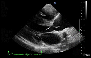 Multiple midline defects identified in a litter of golden retrievers ...
