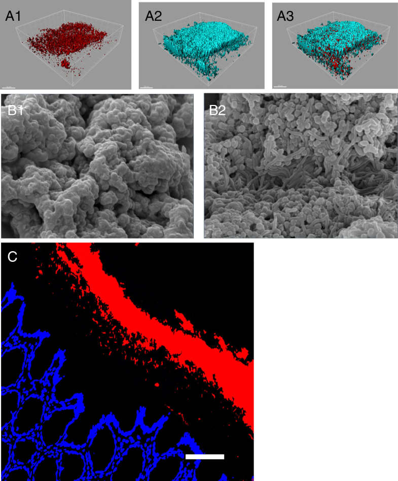 Pathobiont release from dysbiotic gut microbiota biofilms in intestinal ...