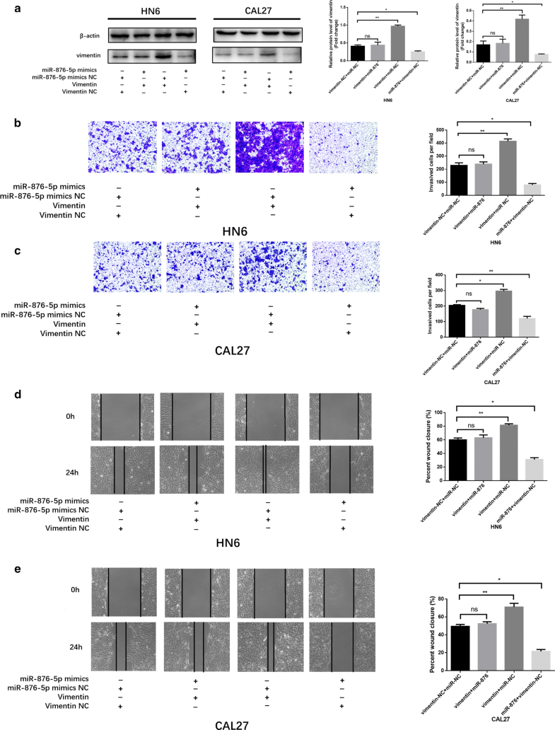 Mir 876 5p Modulates Head And Neck Squamous Cell Carcinoma Metastasis