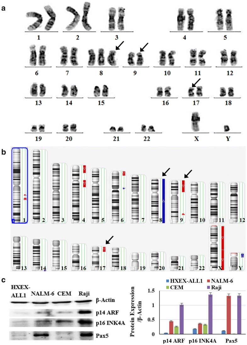 Establishment and characterization of a novel childhood acute ...
