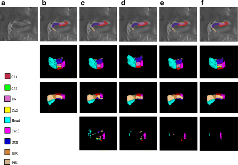 Hippocampal subfields segmentation in brain MR images using generative adversarial networks ...