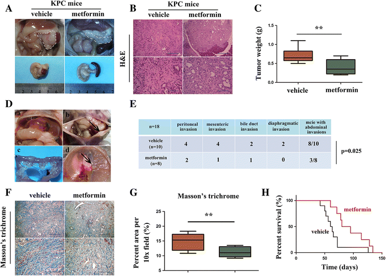 Metformin suppresses cancer initiation and progression in genetic mouse ...