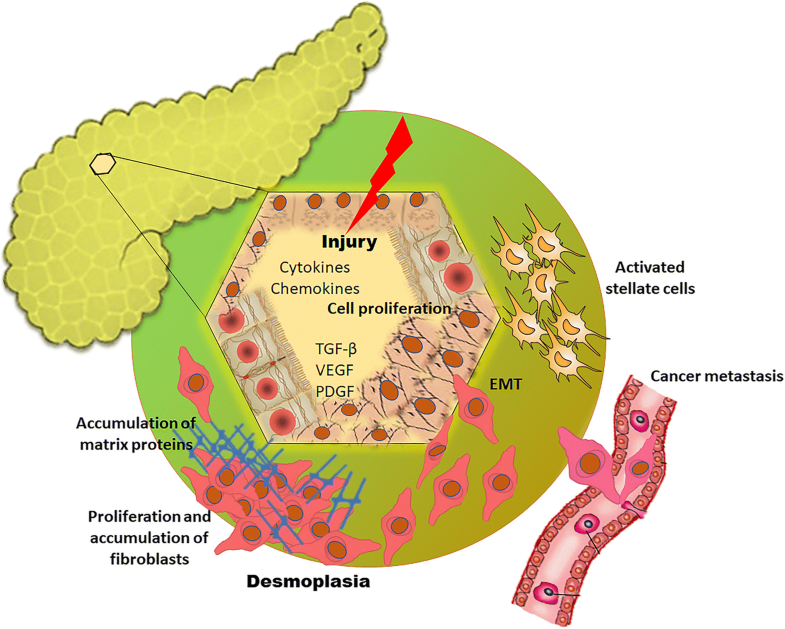Tumor-stromal crosstalk in pancreatic cancer and tissue fibrosis ...