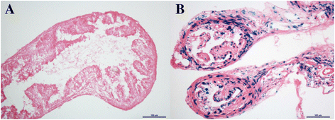 Progesterone-mediated effects on gene expression and oocyte-cumulus ...