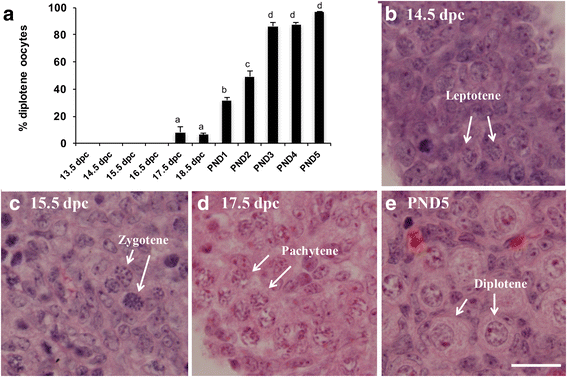 Arrest at the diplotene stage of meiotic prophase I is delayed by ...