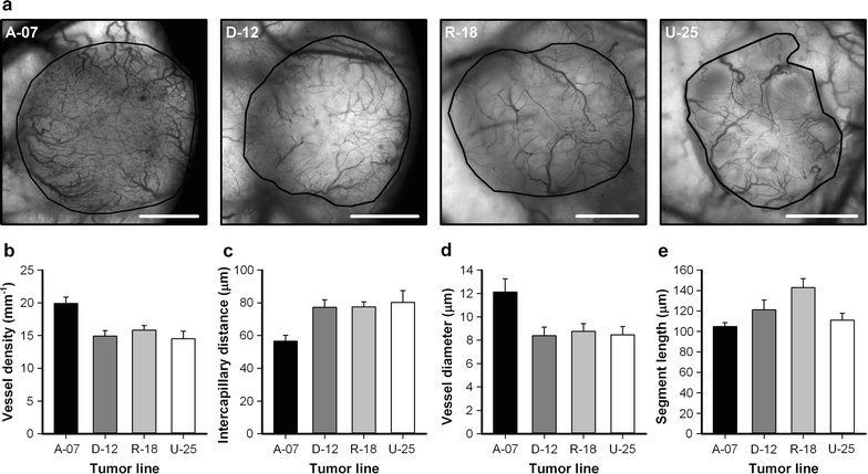 Vascular abnormalities and development of hypoxia in microscopic ...