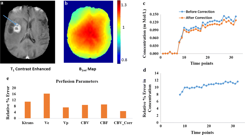 Evaluation of B1 inhomogeneity effect on DCE-MRI data analysis of brain tumor patients at 3T ...