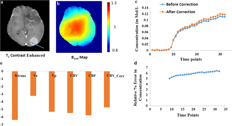 Evaluation of B1 inhomogeneity effect on DCE-MRI data analysis of brain tumor patients at 3T ...