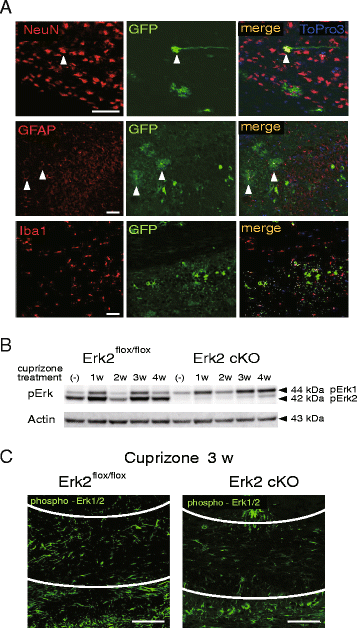 The crucial role of Erk2 in demyelinating inflammation in the central nervous system | Journal ...