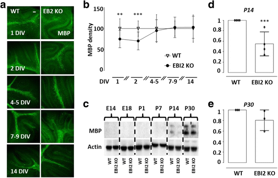 EBI2 receptor regulates myelin development and inhibits LPC-induced ...