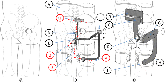 Physical human-robot interaction of an active pelvis orthosis: toward ...