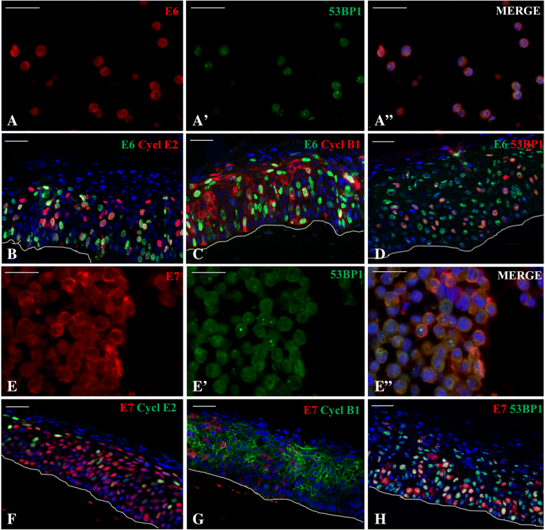 Human Papillomavirus Type 16 E6 And E7 Oncoproteins Interact With The