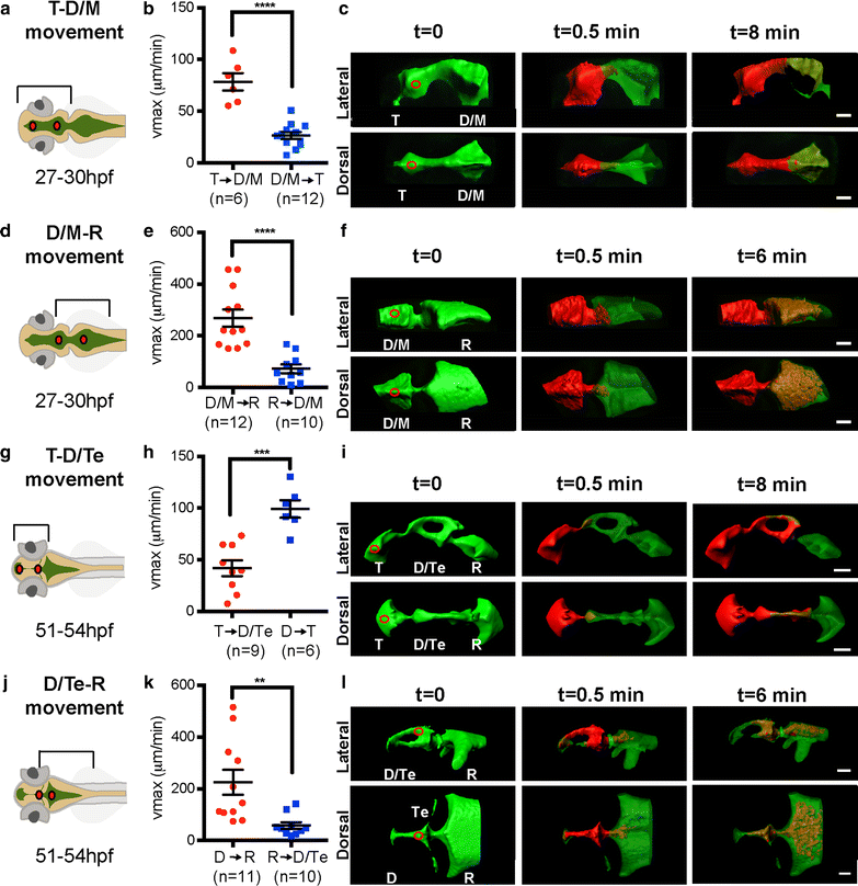Directional cerebrospinal fluid movement between brain ventricles in ...