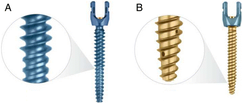 Axial pullout strength comparison of different screw designs ...