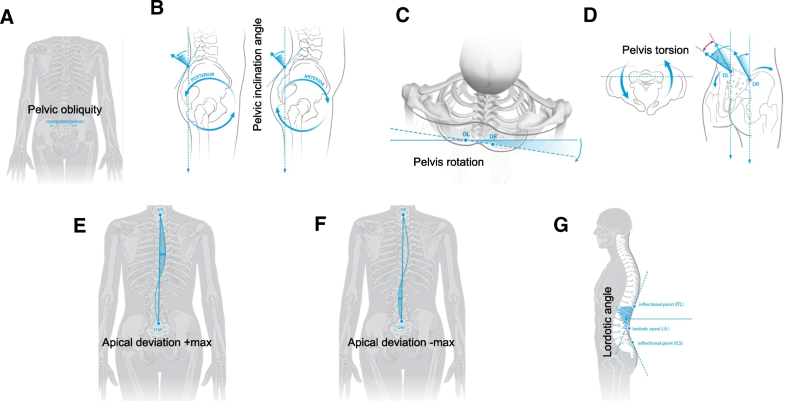 Principal component analysis of the relationship between pelvic ...
