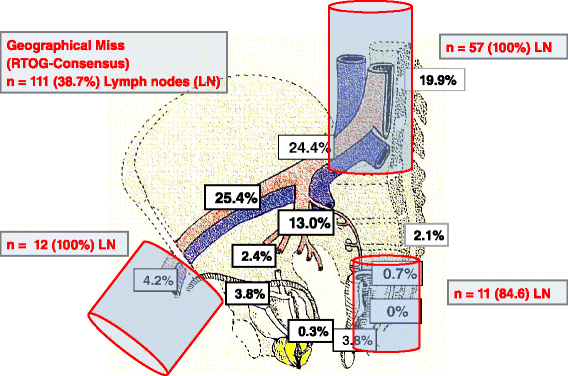 Distribution of prostate nodes: a PET/CT-derived anatomic atlas of ...