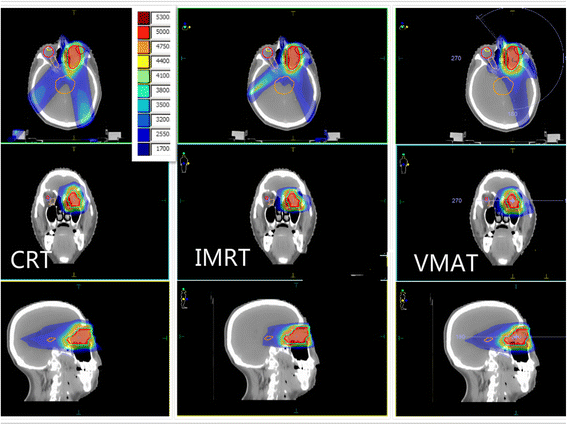 Dosimetric advantage of volumetric modulated arc therapy in the ...