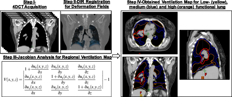 Dosimetric feasibility of 4DCT-ventilation imaging guided proton ...