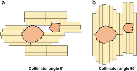 Optimal collimator rotation based on the outline of multiple brain targets in VMAT | Radiation ...
