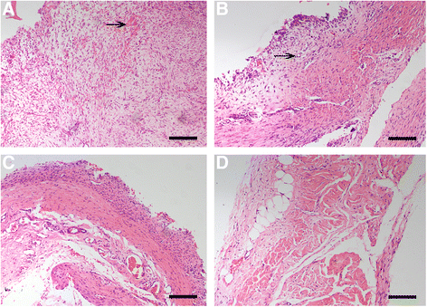 Induction of granulation tissue for the secretion of growth factors and ...