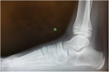 Assessment of the kinesiotherapy’s efficacy in male athletes with ...