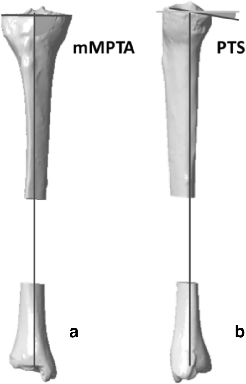 Are three-dimensional patient-specific cutting guides for open wedge ...