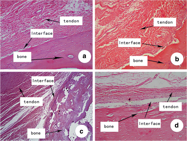 Enhanced tendon–bone healing with acidic fibroblast growth factor ...