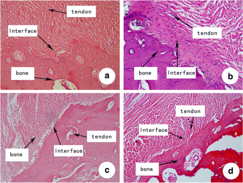 Enhanced tendon–bone healing with acidic fibroblast growth factor ...