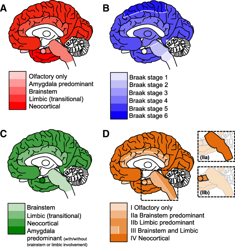 Dementia with Lewy bodies: an update and outlook | Molecular ...