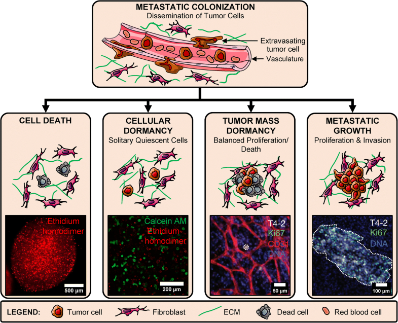 Engineered In Vitro Models of Tumor Dormancy and Reactivation | Journal ...