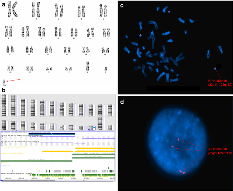 Molecular cytogenetic identification of small supernumerary marker ...
