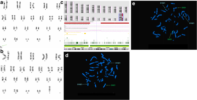 Molecular cytogenetic identification of small supernumerary marker chromosomes using chromosome ...