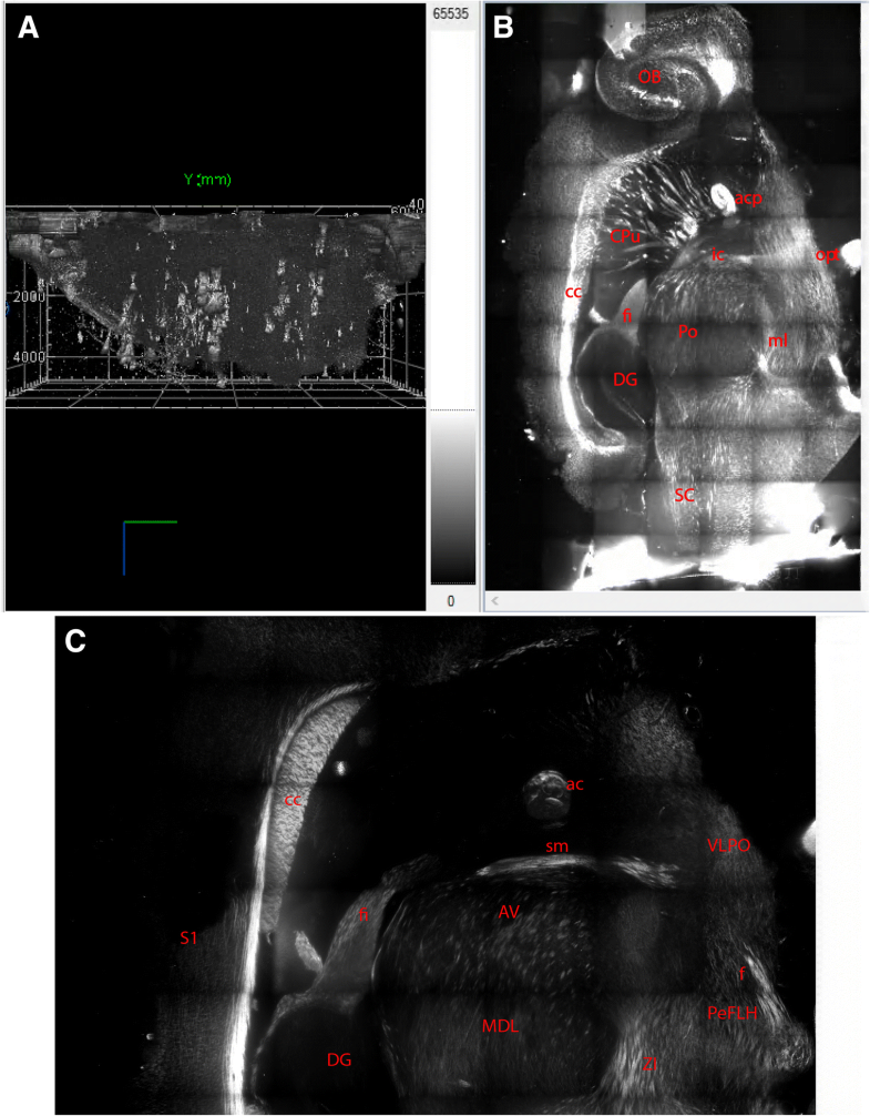 3D imaging of PSD-95 in the mouse brain using the advanced CUBIC method ...