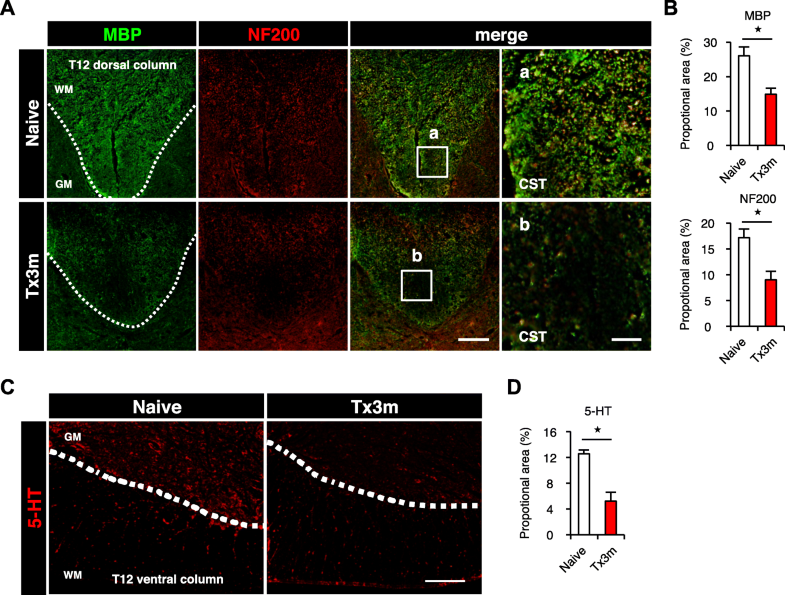 Pathological changes of distal motor neurons after complete spinal cord ...
