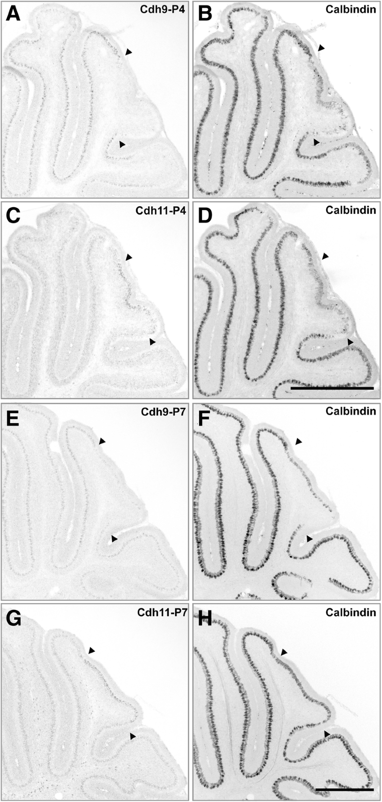 Segregated expressions of autism risk genes Cdh11 and Cdh9 in autism ...