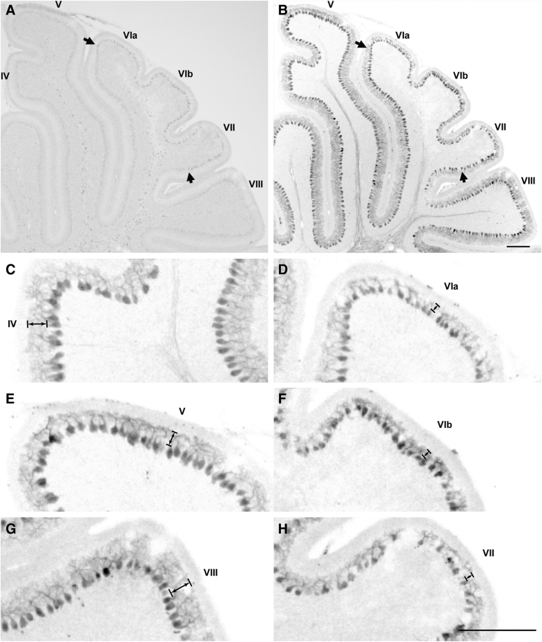 Segregated expressions of autism risk genes Cdh11 and Cdh9 in autism ...