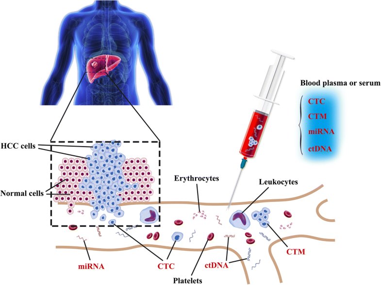 Clinical applications of liquid biopsy as prognostic and predictive biomarkers in hepatocellular ...