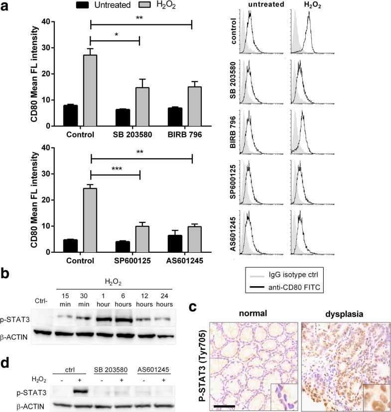 Epithelial CD80 promotes immune surveillance of colonic preneoplastic ...