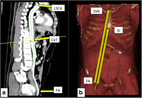 Anatomical landmarks for safely implementing resuscitative balloon ...