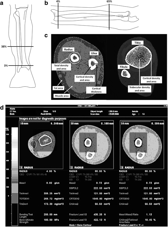 Peripheral quantitative computed tomography (pQCT) for the assessment ...