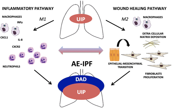 Acute exacerbation of idiopathic pulmonary fibrosis: lessons learned ...