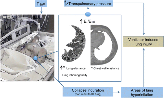 Acute exacerbation of idiopathic pulmonary fibrosis: lessons learned ...