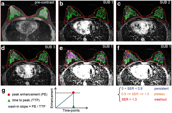 Breast MRI contrast enhancement kinetics of normal parenchyma correlate ...