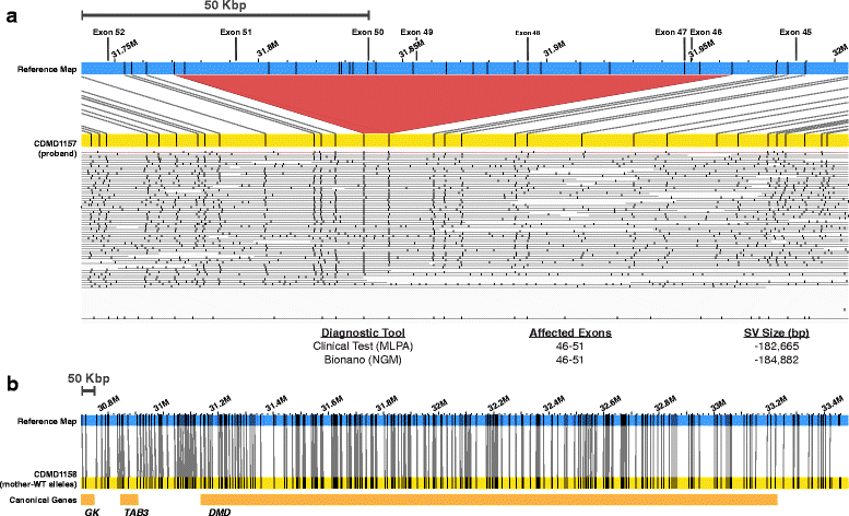 Next-generation mapping: a novel approach for detection of pathogenic structural variants with a ...
