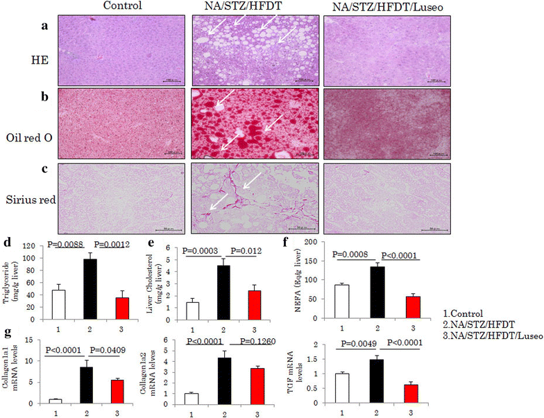 Treatment with the SGLT2 inhibitor luseogliflozin improves nonalcoholic ...