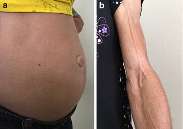 Clinical and laboratory data of a large series of patients with ...