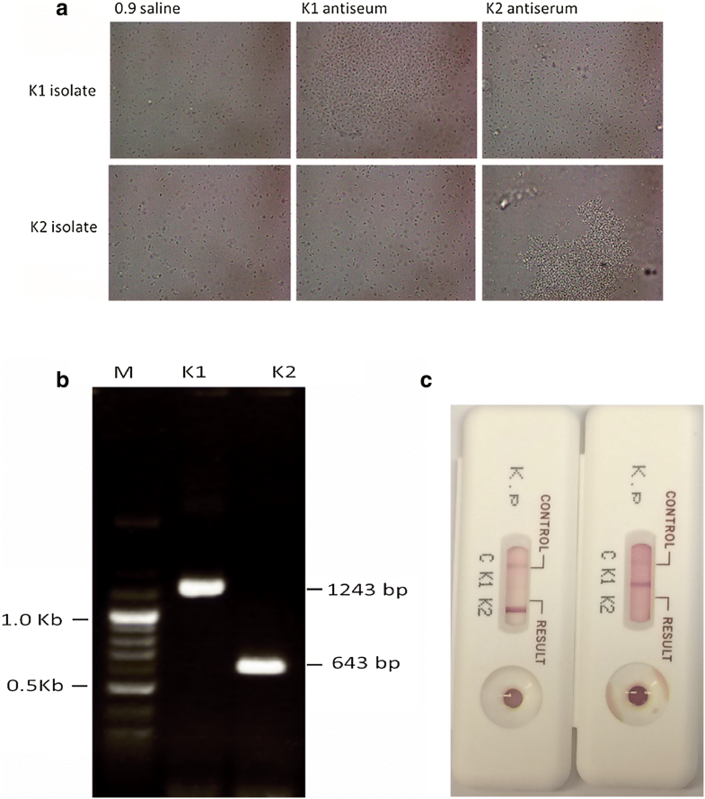 Rapid identification of capsular serotype K1/K2 Klebsiella pneumoniae in pus samples from liver ...