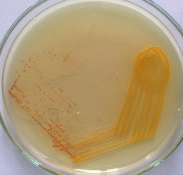 Unforeseeable presentation of Chryseobacterium indologenes infection in ...