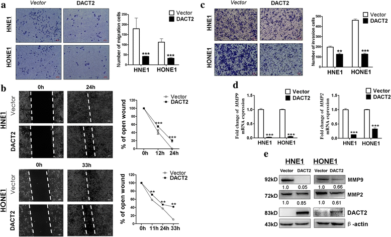 The new 6q27 tumor suppressor DACT2, frequently silenced by CpG ...